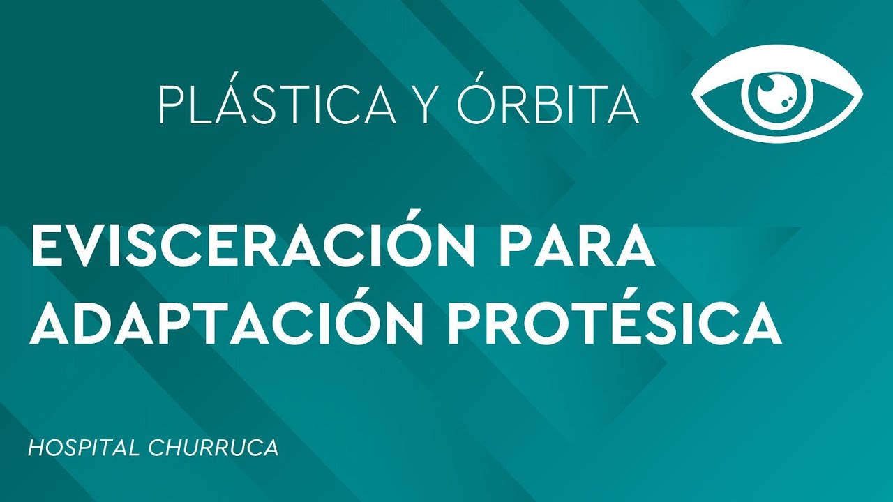 Evisceración para mejorar la adaptación protésica - EduPoen ...